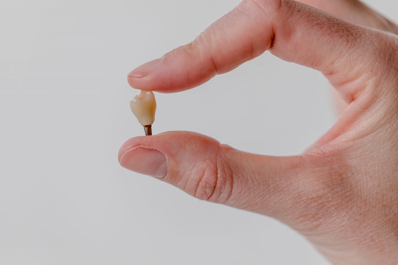 Zahnarztpraxis Gerwe – Wir sind für Sie und Ihre Zähne da